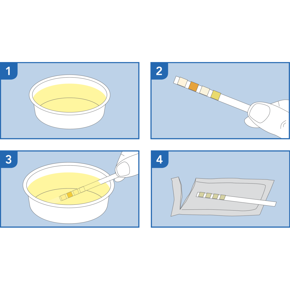 Urinary Tract Infections Test - Prima Home Test | HealthPorter ...